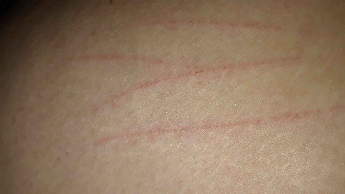 Random scratch marks - General Discussion - Become A Living God